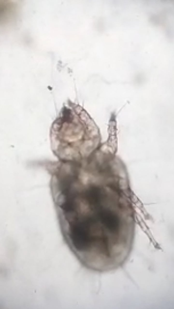 Cotton Dust Mite : साठवलेल्या कापसातील डस्ट माईटची पैदास कशी रोखायची ...