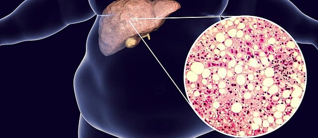 How to grow human mini-livers in the lab to help solve liver disease