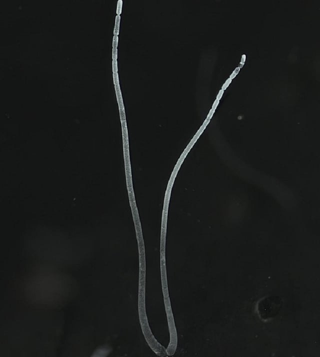 Giant: Meet a bacterium that is visible to the naked eye