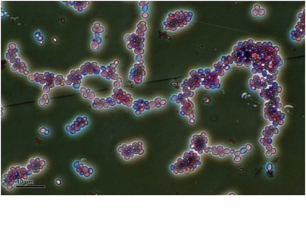 Study identifies gene that could help fight lethal infection Candidiasis