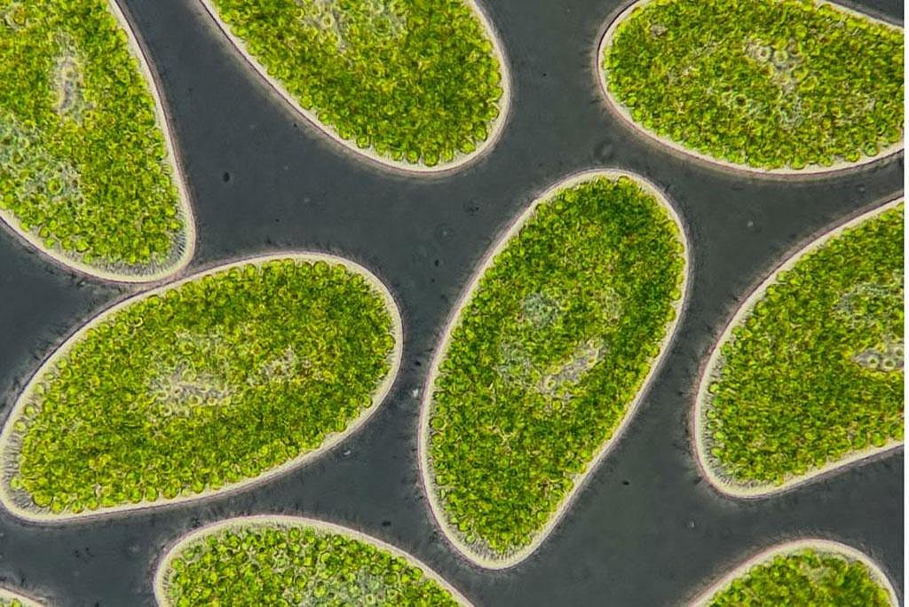 जलवायु परिवर्तन पीटलैंड में छिपे सूक्ष्मजीवों के खाद्य जाल को बदल कर ...