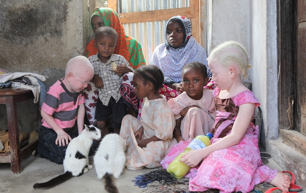 WHO Milestone: Sunscreen Added to Essential Medicines for Albinism