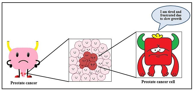 Prostate Cancer Cartoons Prostate Cancer Humor