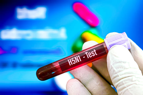 US Bird Flu Alert: First Human H5N1 Case Since February Reported