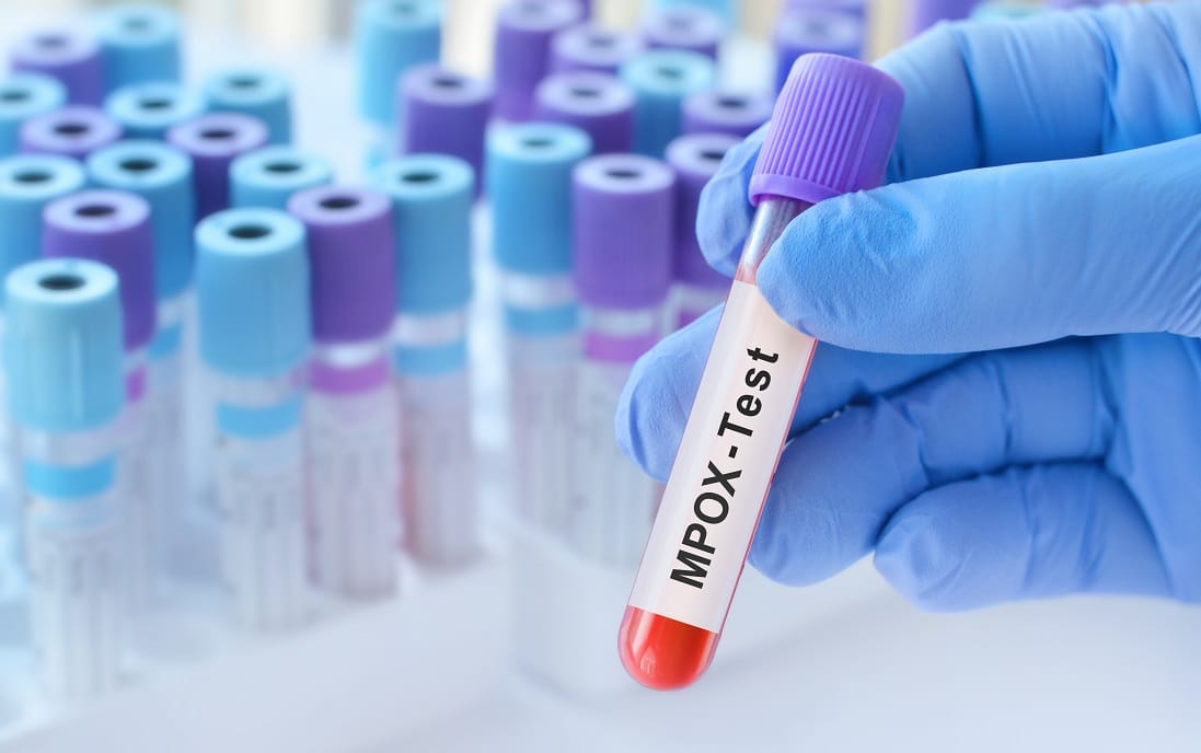 Kerala Detects Global Clade Ib Mpox Strain, Highlights India's ...