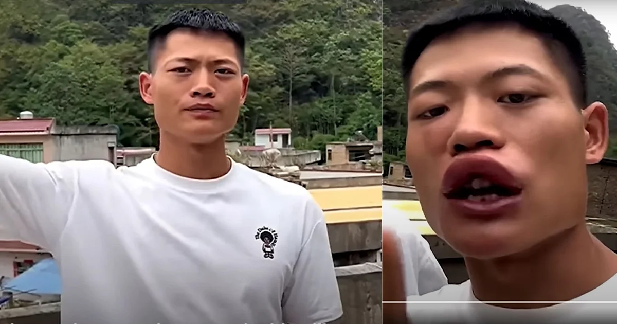 Chinese Influencer Banned For Wasp Eating Video Stunt That Caused His