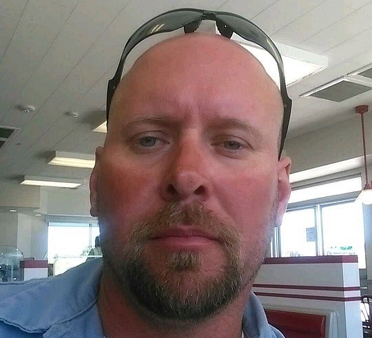 Man Maimed by Electric Shock Receives First-Ever Face Transplant That ...