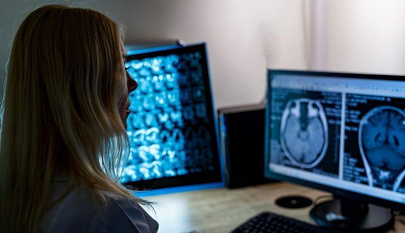 Gpt Ids Errors In Reports With Same Accuracy As Radiologists Mednews 