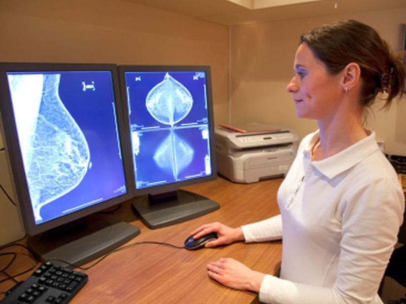 En una de cada cuatro lumpectomías para el cáncer de mama se necesita ...