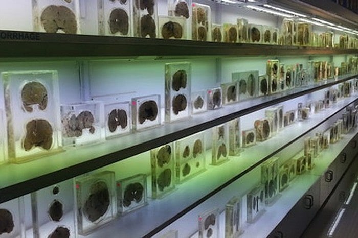 Visit this Brain Museum In Bangalore, India