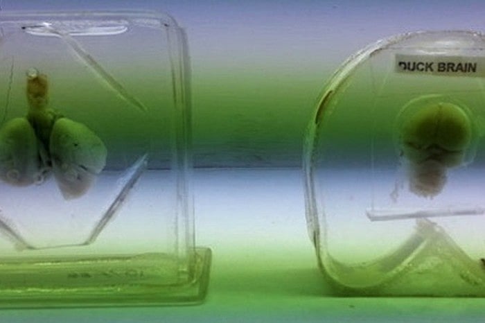 Visit this Brain Museum In Bangalore, India