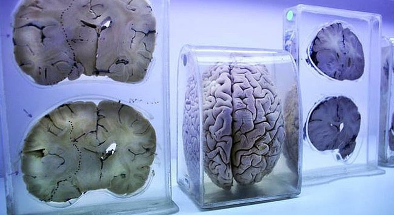 Black Magic, Brains & Brooms: 11 Unusual Museums To Visit In India