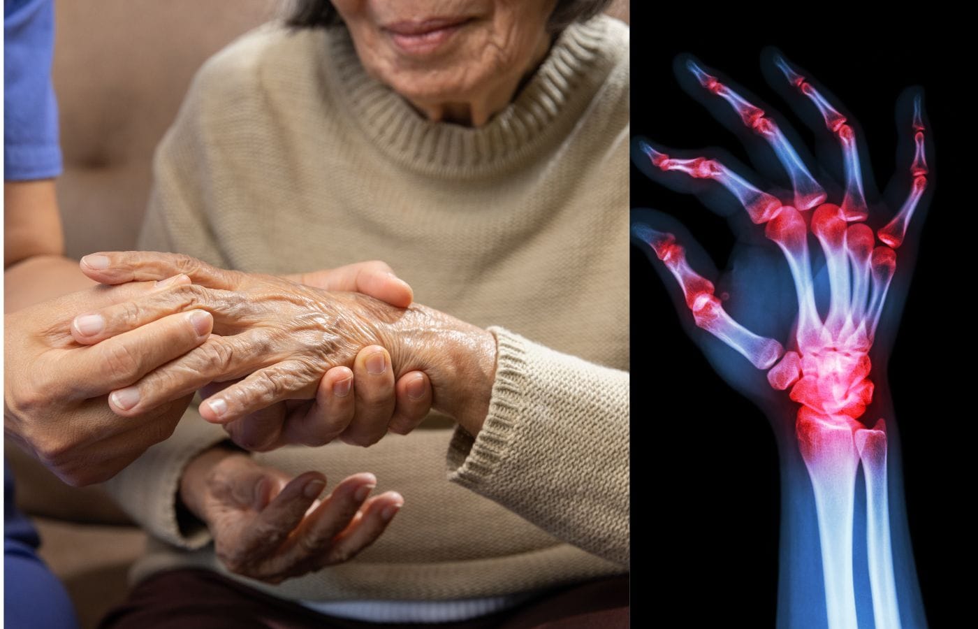 What is rheumatism Why does it occur and the treatments