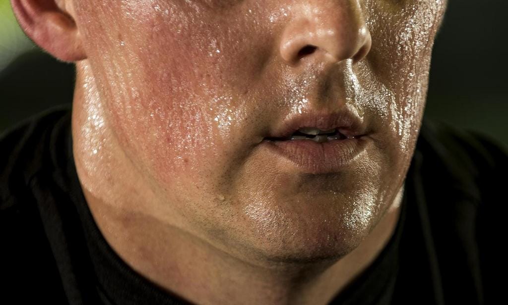 excessive sweating good or bad?