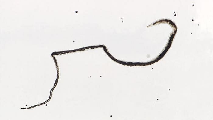 Not only Slugs, snails cause rat lungworm disease in humans