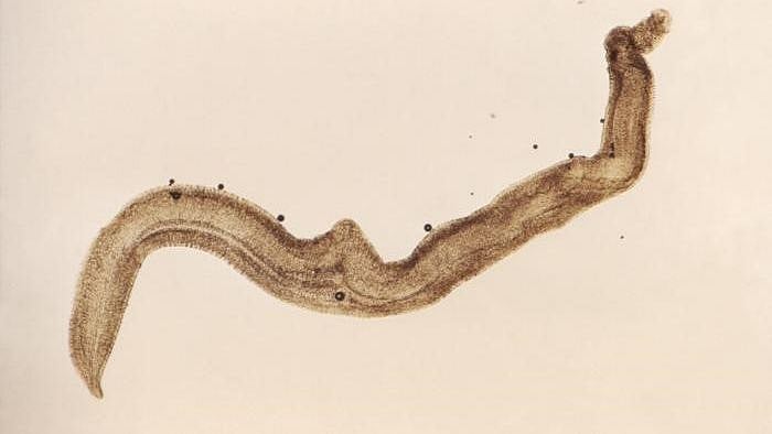 Not only Slugs, snails cause rat lungworm disease in humans