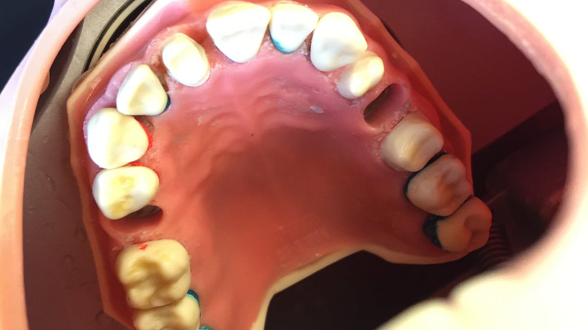 Sink your teeth into this!