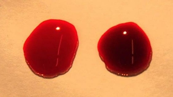 KRISS Develops Dried Blood Spot Certified Reference Materials for ...