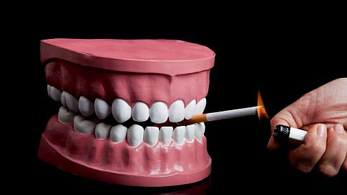 Heavy smokers with severe periodontitis receive no benefit from treatment