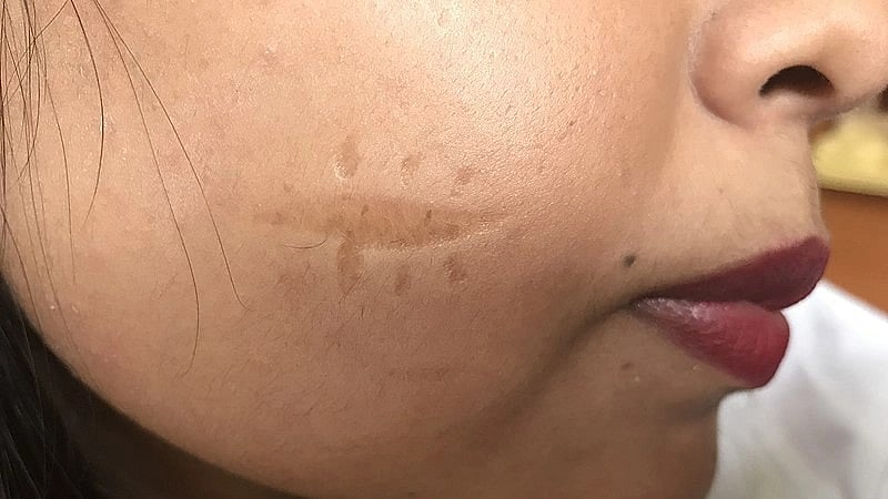 Medicines that modify the circadian clock might help heal scars more ...