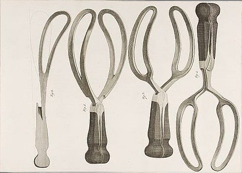 The Child Extractor-History & Evolution of the Obstetric Forceps