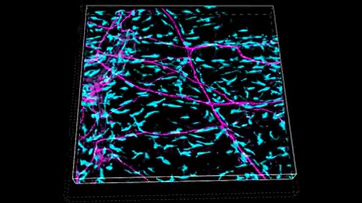 How Bacteria Invade the Brain