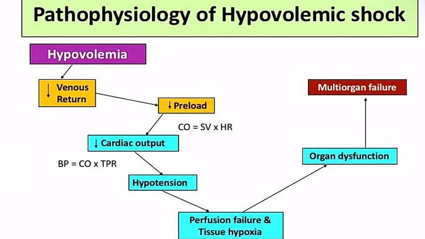 MIP Presentation on Hypovolemic Shock.