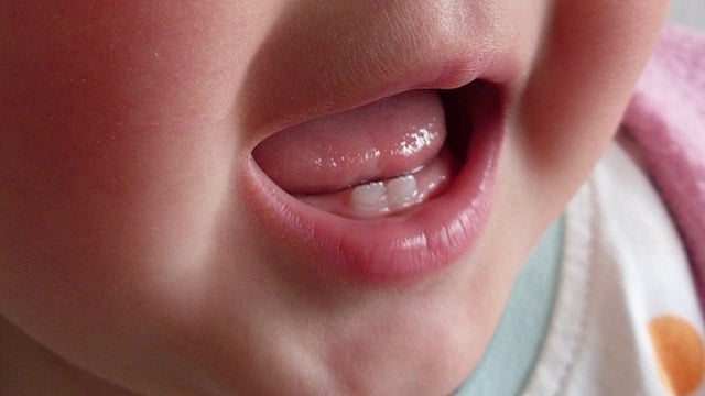 Child's First Dental Visit: Building Lifelong Oral Health
