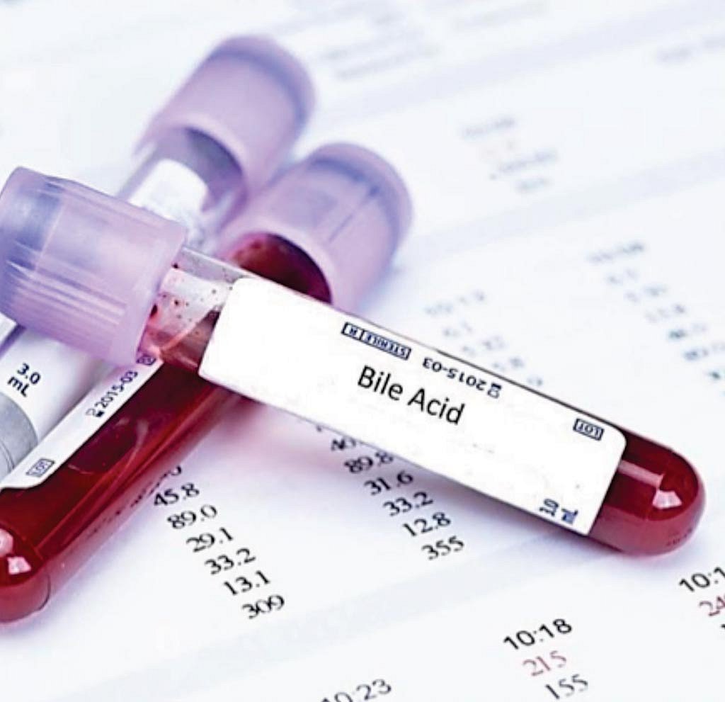 Thousands Suffer from Bile acid diarrhea A New Method Makes Identifying ...