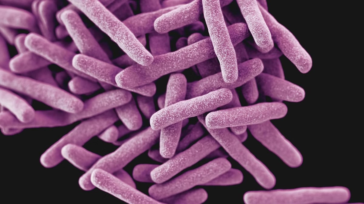 Bacterial-cords-key-to-understanding-tuberculosis-infections