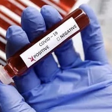 Humorous memes, jokes relieve stress in tough corona times