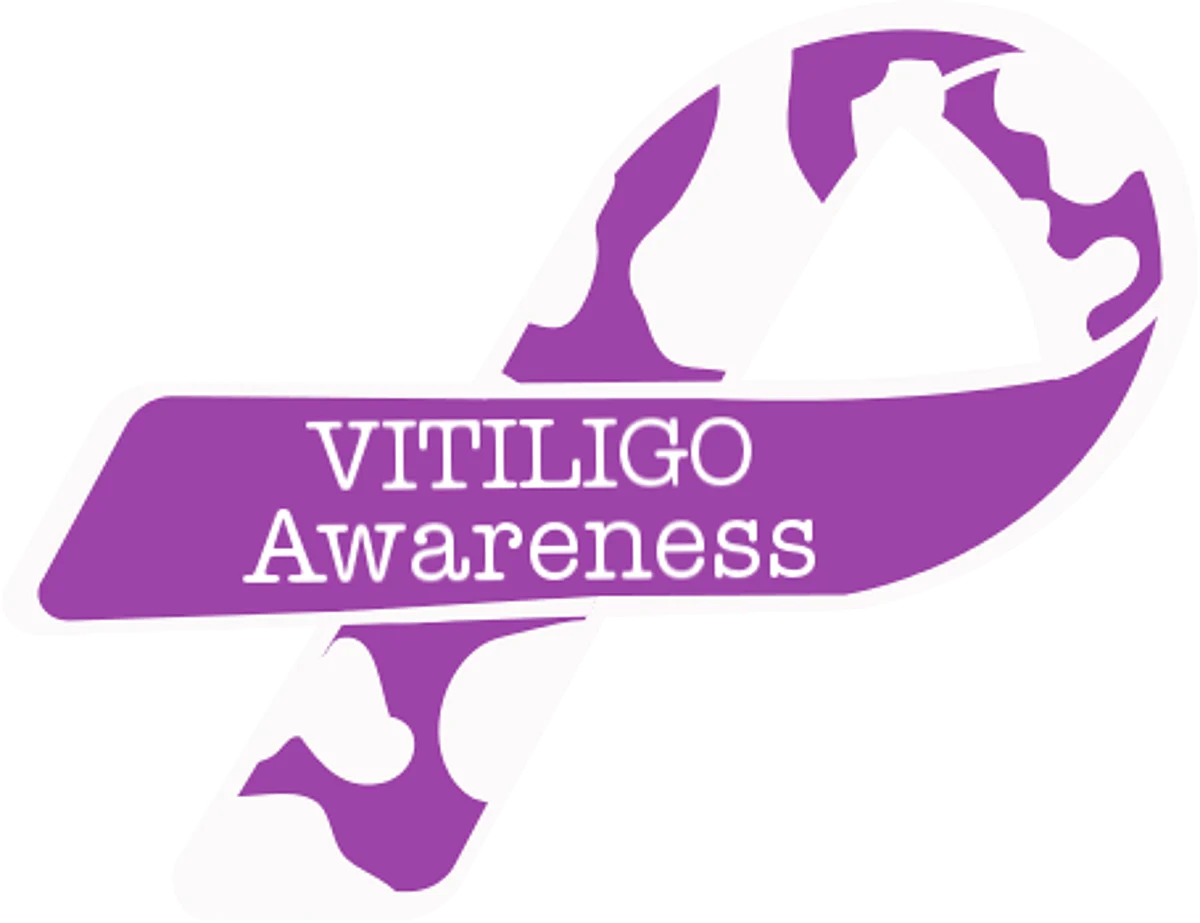 Vitiligo Walk In City