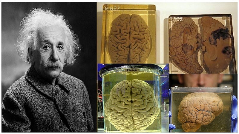 einstein brain was theft. because of he was genious. Doctors said we ...