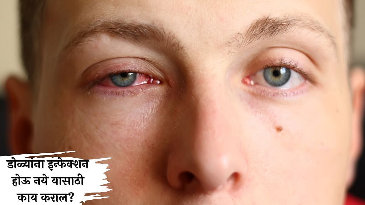 पुण्यात डोळ्यांची साथ फोफावली, एकाच दिवशी आढळले हजाराहून अधिक रुग्ण ...