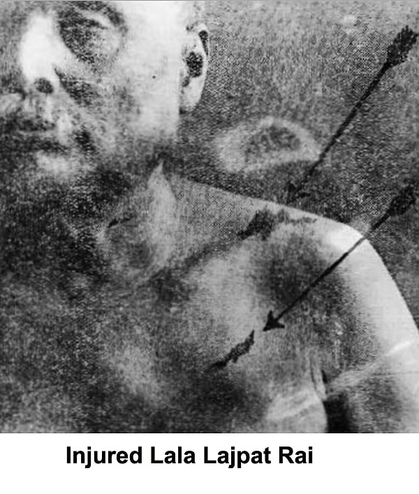 Remembering India’s Debt To Lala Lajpat Rai