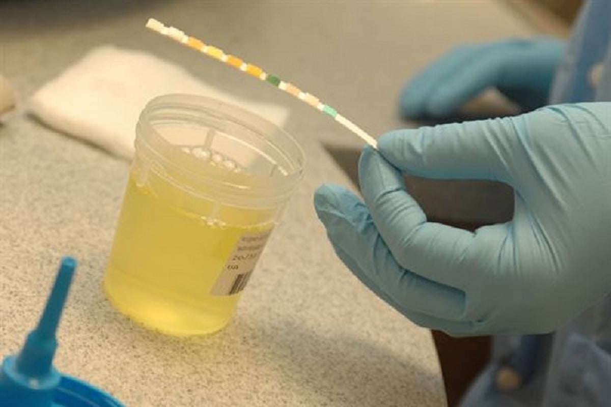 Health Check What Can Your Doctor Tell From Your Urine health-check-what-can-your-doctor-tell-from-your-urine