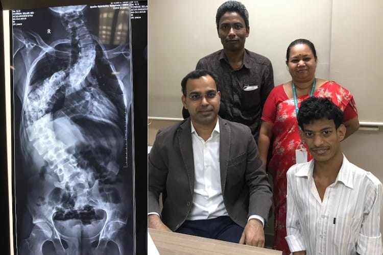 A surgical feat: How doctors fixed this man's twisted spine to free him ...